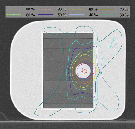 Physics | Radiology Key