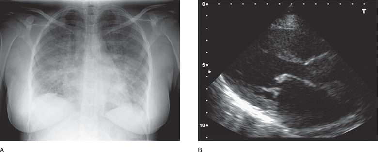 Cardiac | Radiology Key