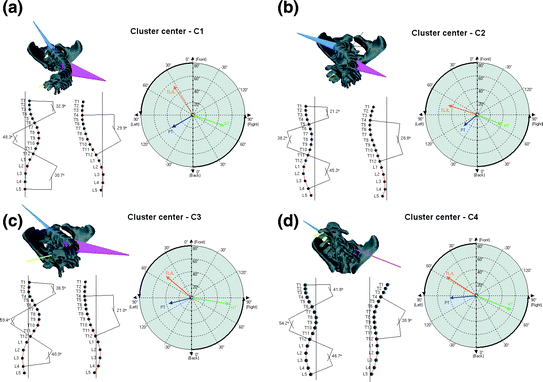 Spine Reconstruction from Radiographs | Radiology Key