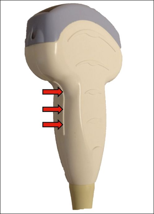 the probe | Radiology Key