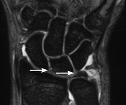 Difficult Cases | Radiology Key