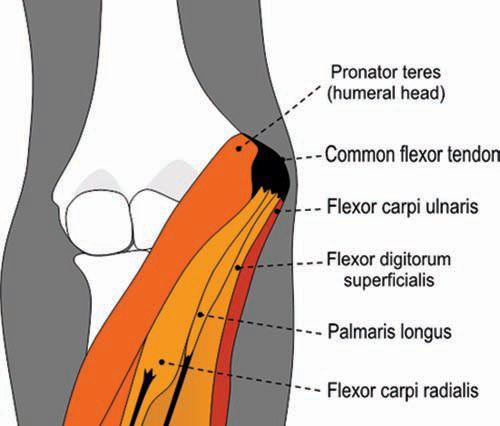 Elbow Tendons And Epicondylitis Radiology Key Elbow Tendons And Epicondylitis Radiology Key