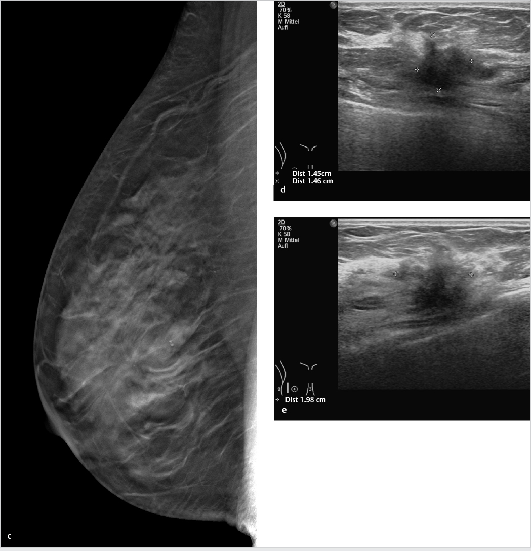 Illustrative Case Reports | Radiology Key