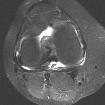 Knee | Radiology Key
