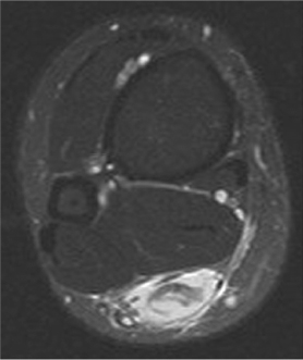 Lower Leg | Radiology Key