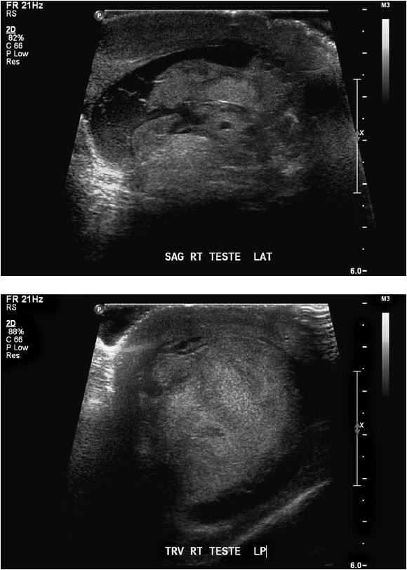 Genitourinary Ultrasound | Radiology Key