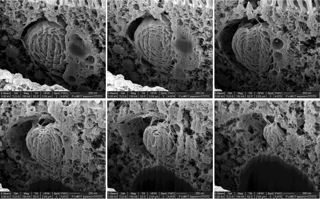 3D Imaging of Cells and Tissues by Focused Ion Beam/Scanning Electron ...