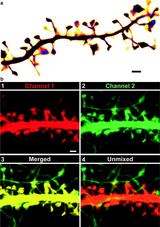 Two-Color STED Imaging of Synapses in Living Brain Slices | Radiology Key