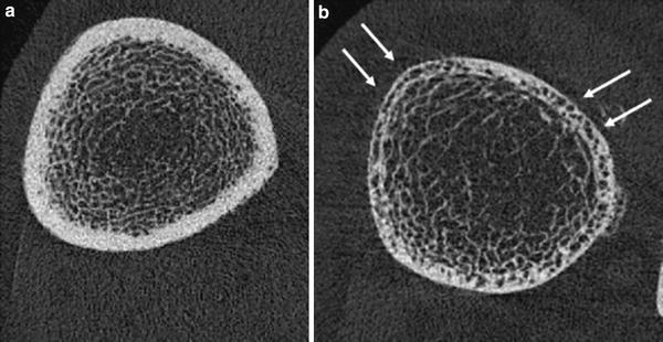 and Peripheral QCT | Radiology Key