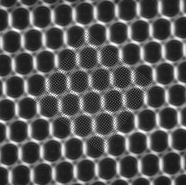 Cryo-electron Microscopy of Membrane Proteins | Radiology Key