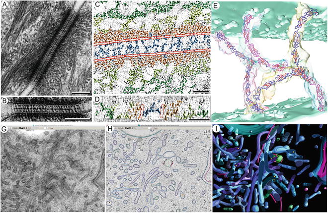 Electron Tomography for Organelles, Cells, and Tissues | Radiology Key