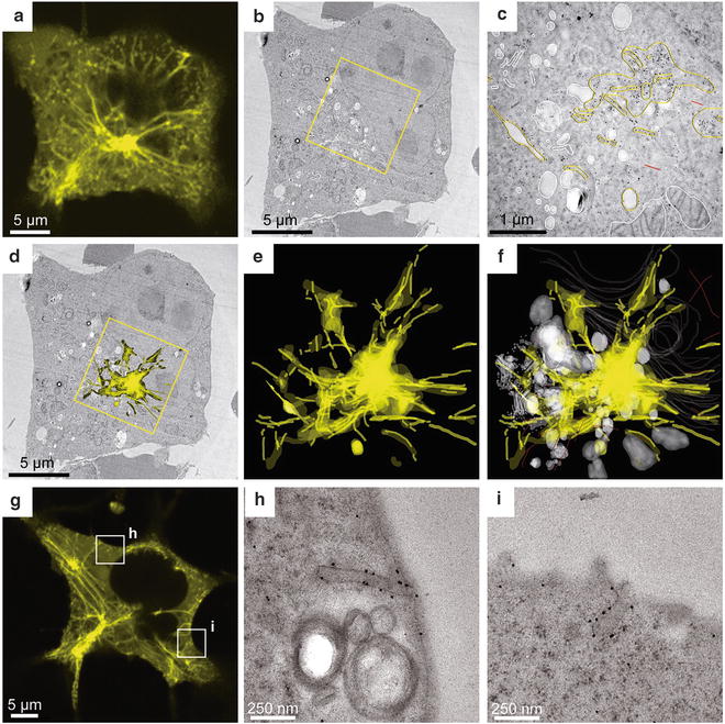 Correlative Light and Electron Microscopy: From Live Cell Dynamic to 3D ...