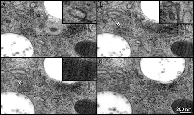 Three-Dimensional Imaging of Adherent Cells using FIB/SEM and STEM ...