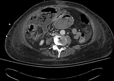 Stomach | Radiology Key