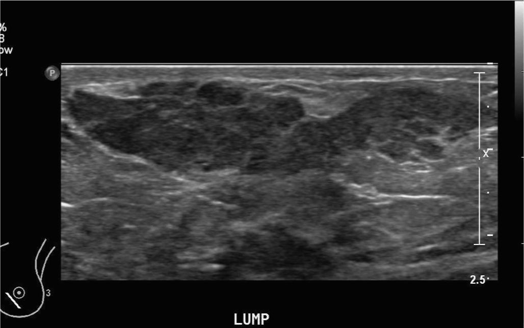 Difficult Cases | Radiology Key