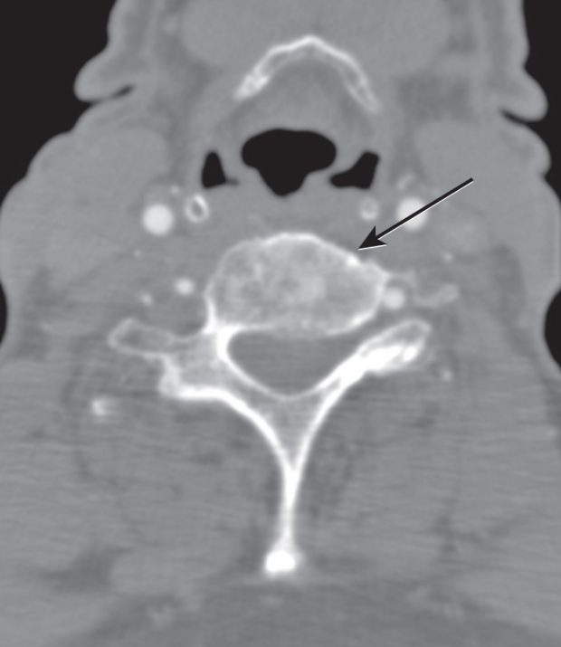 The Cranial Nerves | Radiology Key