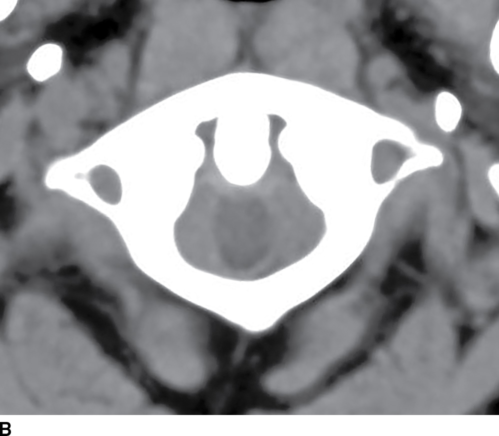 Approach to Mimics and Look-Alikes: Common Differential Diagnoses in ...