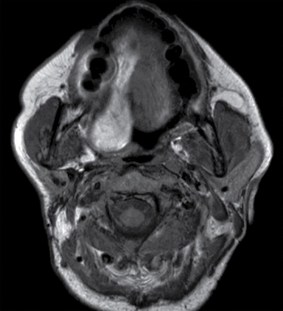 Approach to Mimics and Look-Alikes: Common Differential Diagnoses ...