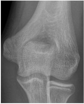 Normal/Normal Variants | Radiology Key