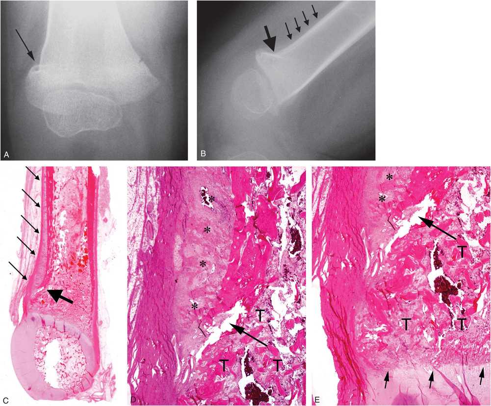 Skeletal trauma: general considerations | Radiology Key
