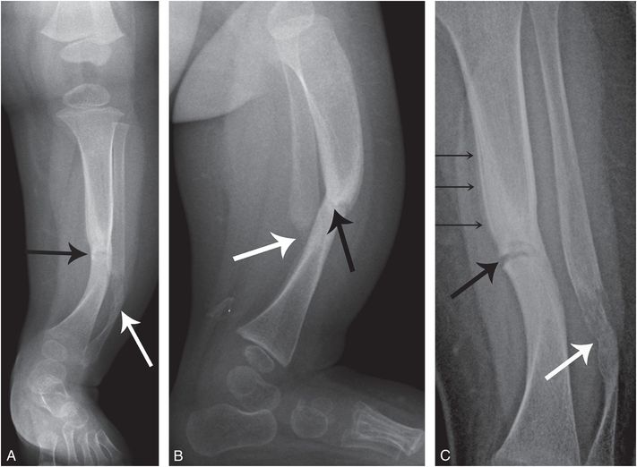 Differential diagnosis I: diseases, dysplasias, and syndromes ...