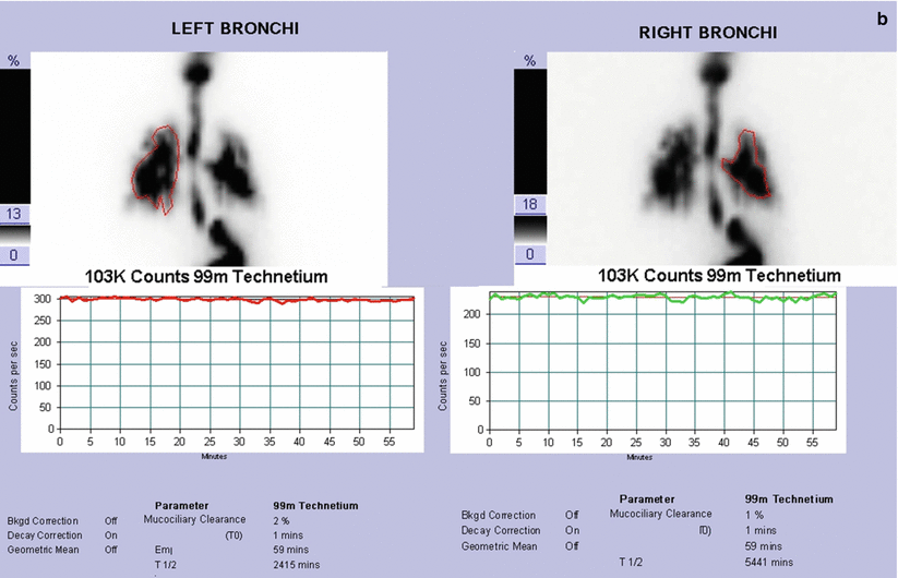 Bronchopneumology | Radiology Key