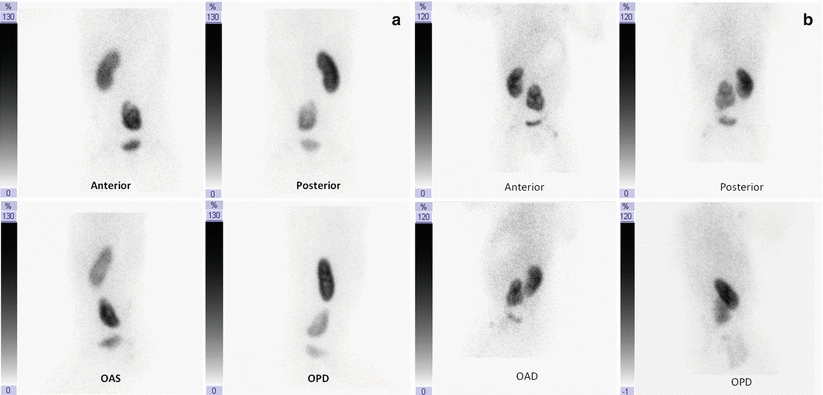 Nephrourology: Urinary Tract Infections | Radiology Key