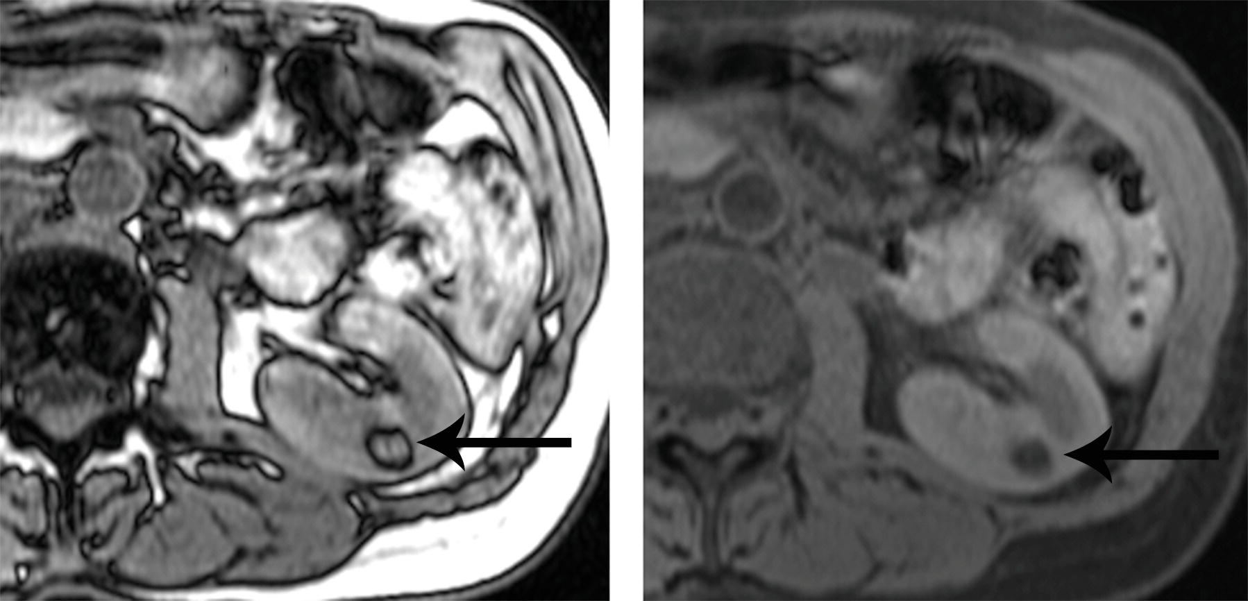 Multisystem and Miscellaneous | Radiology Key