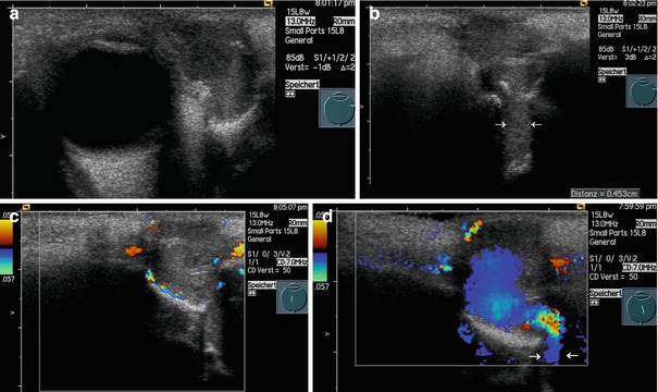 Doppler Sonography of the Head and Neck | Radiology Key