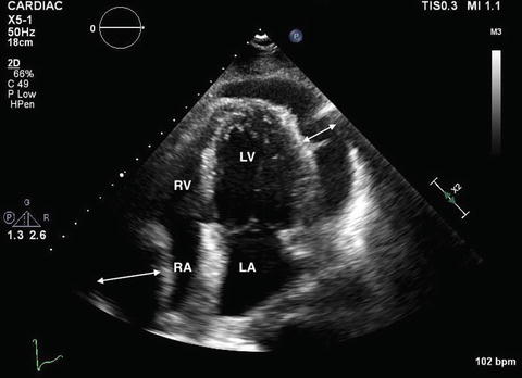 Cardiology | Radiology Key
