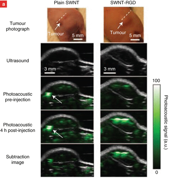 for Photoacoustic Imaging of Cancer | Radiology Key