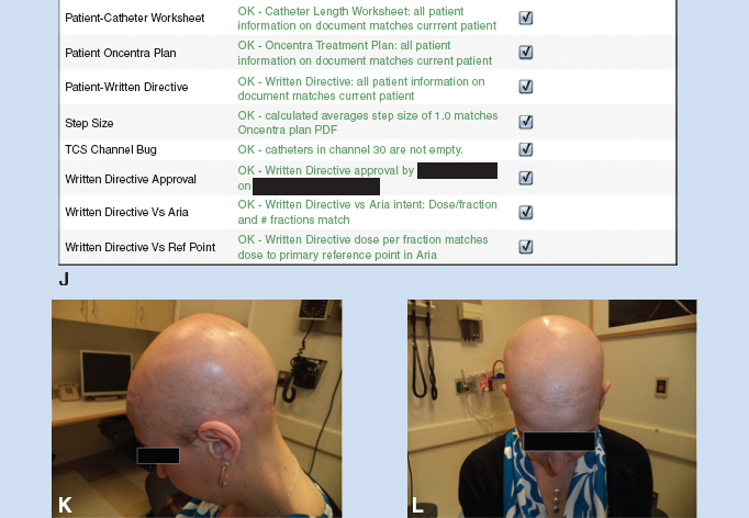 Technical Aspects of Brachytherapy | Radiology Key
