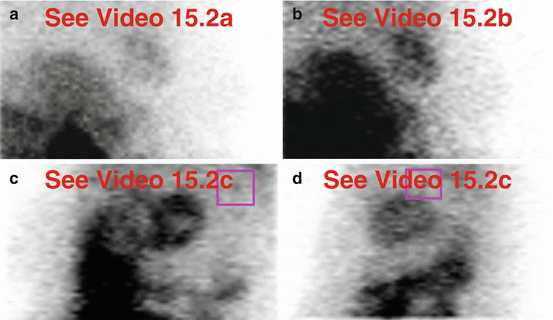 Lymphatic System | Radiology Key