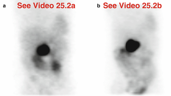 Kidneys and Female Reproductive System | Radiology Key
