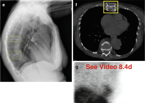 Skeleton | Radiology Key