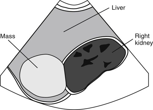 Scanning Protocol for Abnormal Findings/Pathology | Radiology Key