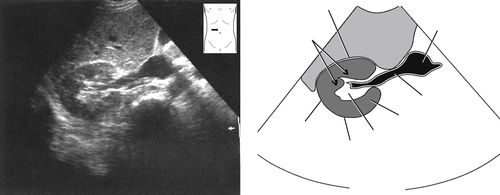 Renal Scanning Protocol | Radiology Key