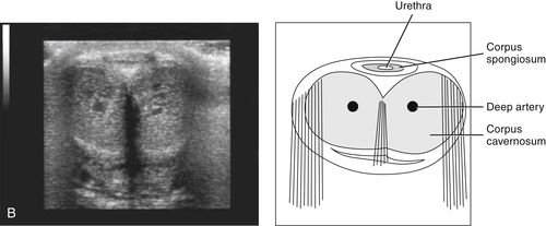 Male Pelvis Scanning Protocol for the Prostate Gland, Scrotum, and ...