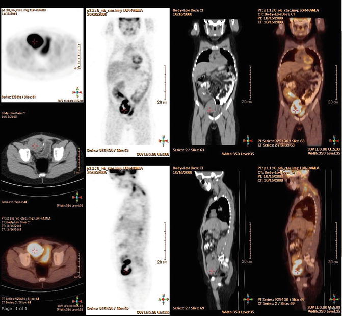 Pediatric Imaging | Radiology Key
