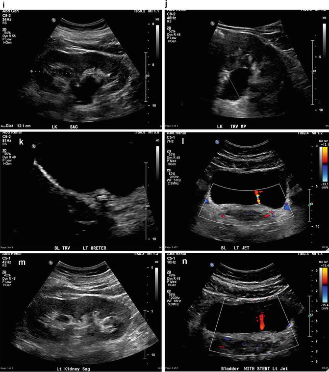 Penile Ultrasound | Radiology Key