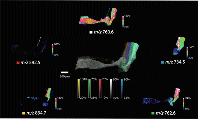 Imaging MS of Rodent Ocular Tissues and the Optic Nerve | Radiology Key