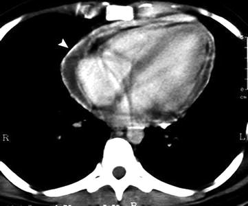 Cardiology | Radiology Key