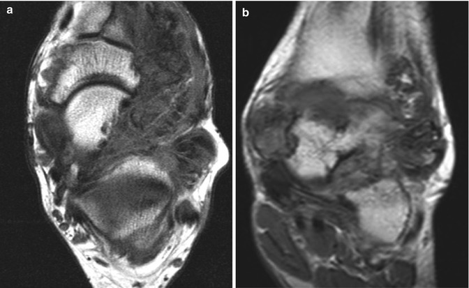 Grading and Tissue-Specific Diagnosis | Radiology Key