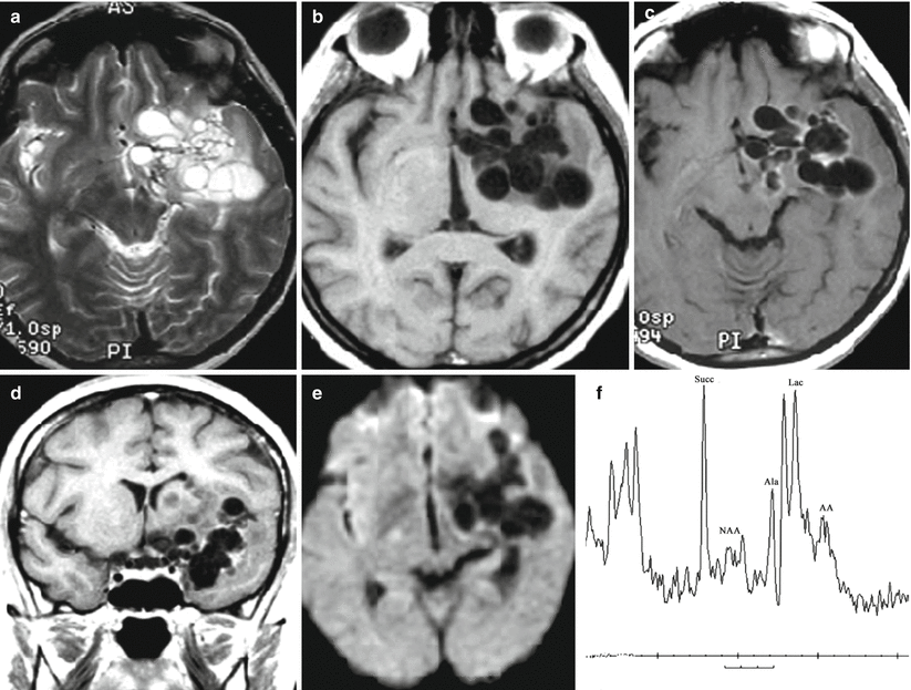 Parasitic Infestations | Radiology Key