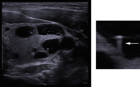 Principles of Ultrasound and Applied Ultrasound Physics Relevant for ...