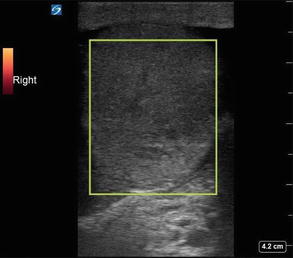 Pediatric Ultrasound | Radiology Key