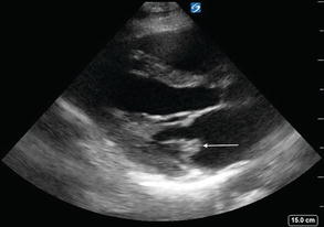 Cardiac Ultrasound | Radiology Key