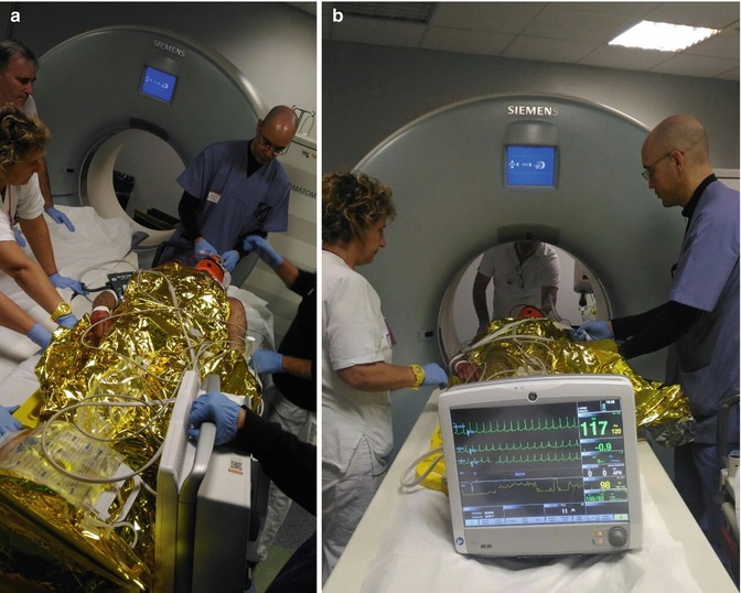 Management of Polytrauma Patients | Radiology Key
