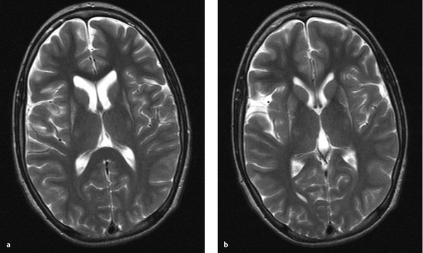 Metabolic Disorders | Radiology Key