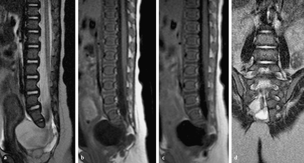 Malformations and Developmental Abnormalities | Radiology Key
